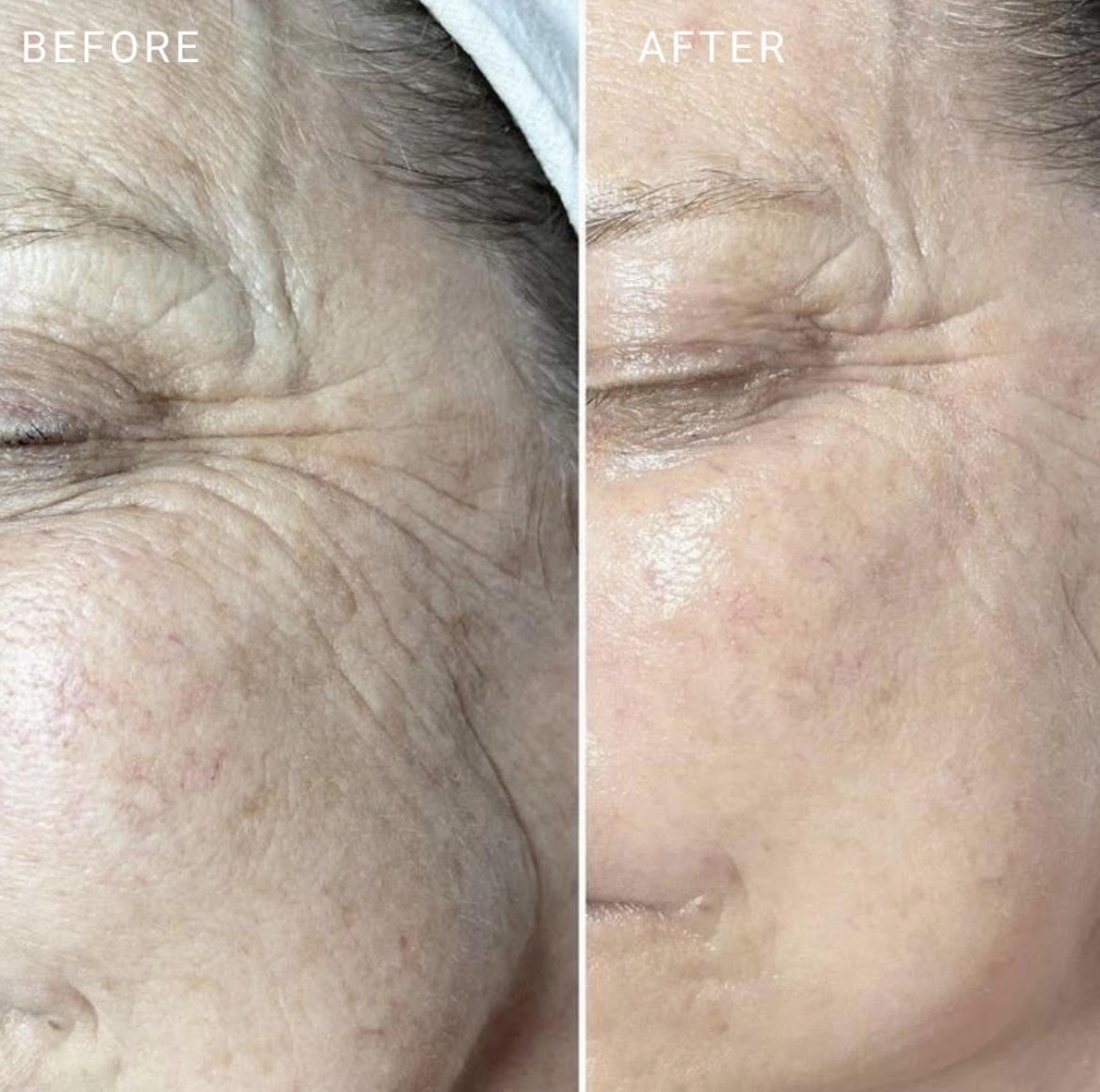 Hydrolifting Signature Facial Treatment | Lashiqué